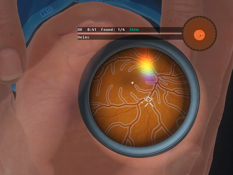 Eyesi Indirect ROP - Standardized curriculum